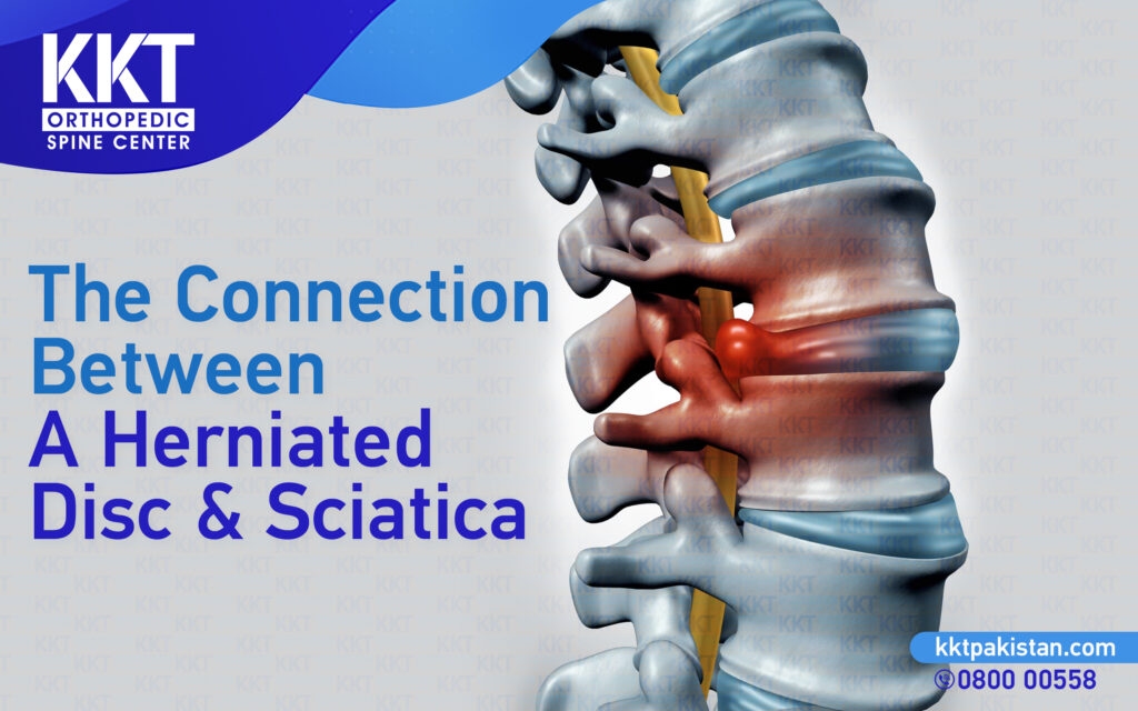 The connection between a herniated disc and sciatica: - KKT Orthopedic ...