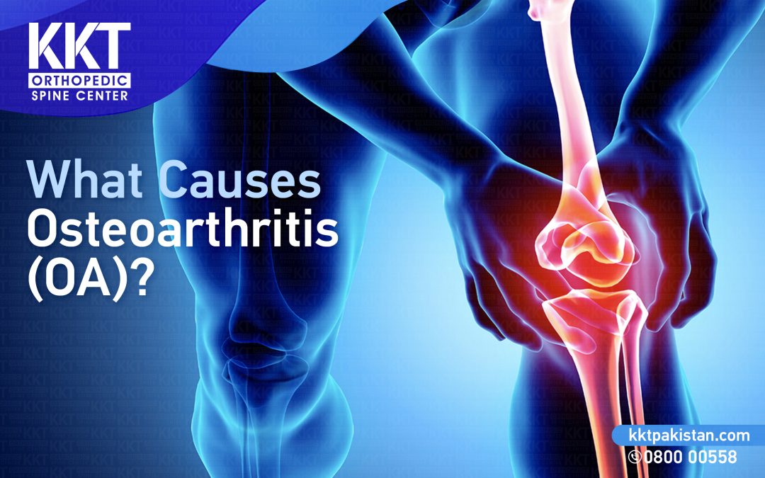 What Causes Osteoarthritis KKT Pakistan Pakistan s Only Non What Causes Osteoarthritis KKT Pakistan Pakistan s Only Non